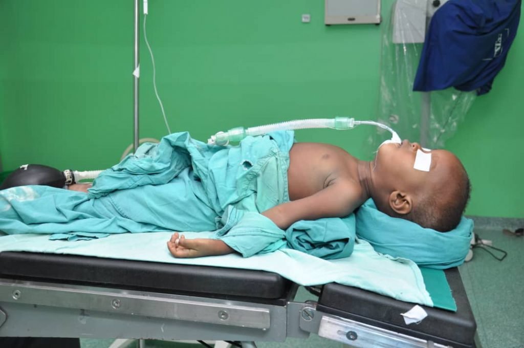 How AKTH Makes Life Easier For Cleft Patients - The Jour